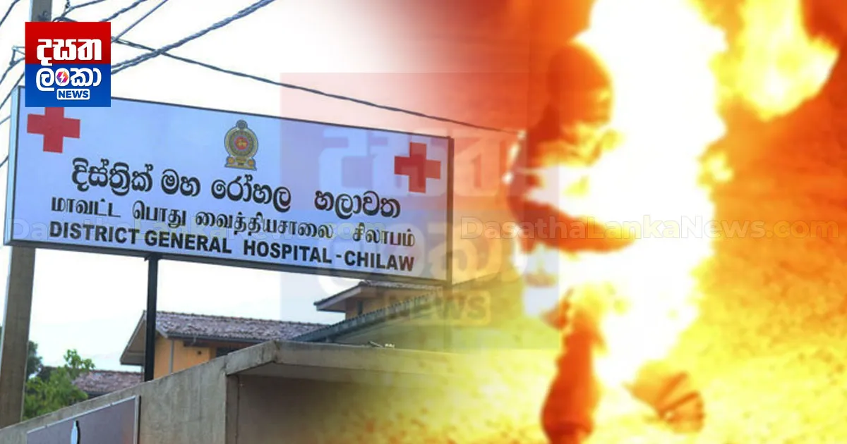 තරුණියක් සමඟ ඇති වූ බහින් බස්වීමකින් පසු තරුණයෙක් ගිනි තබාගෙන මිය යයි ...